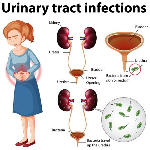 Urinary Tract Infection Uti Symptoms PHARMACY FIRST Urinary Tract
